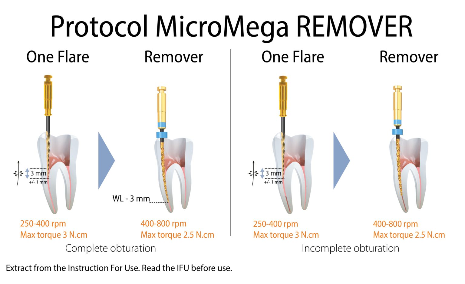 Lima Micromega Remover 30/07 5un – Vimardent
